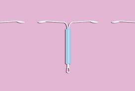 Long-term health risks and benefits of the copper coil - The Femedic